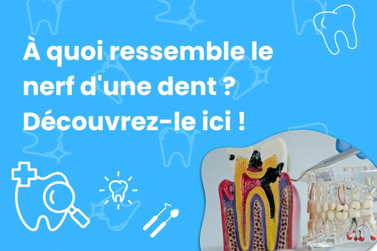 À quoi ressemble le nerf d'une dent ? Découvrez-le ici