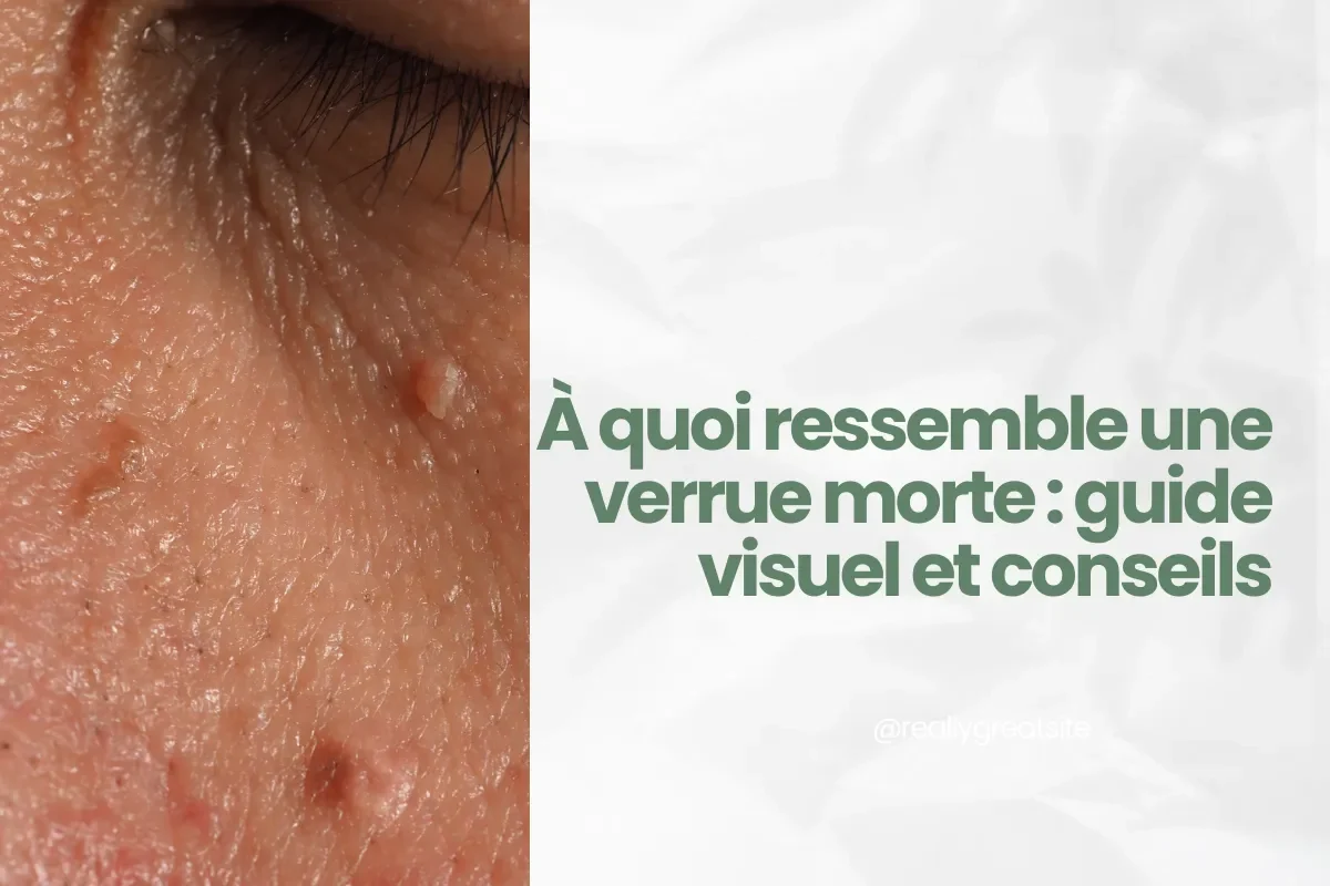 À quoi ressemble une verrue morte : guide visuel et conseils